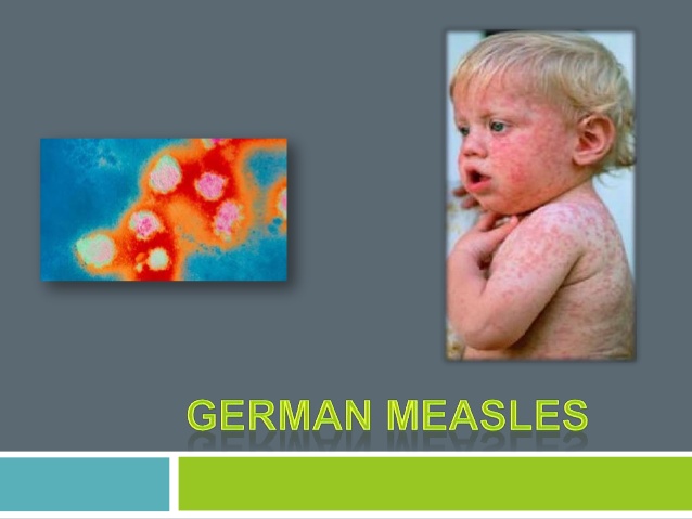 Asal usul, Penyebab, Gejala, bahaya, dan Pencegahan German Measles ...